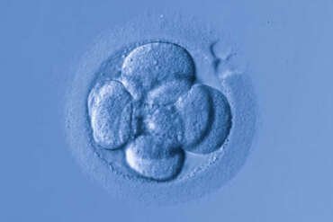 Laser Assisted Hatching - Best IVF Specialist In Faridabad